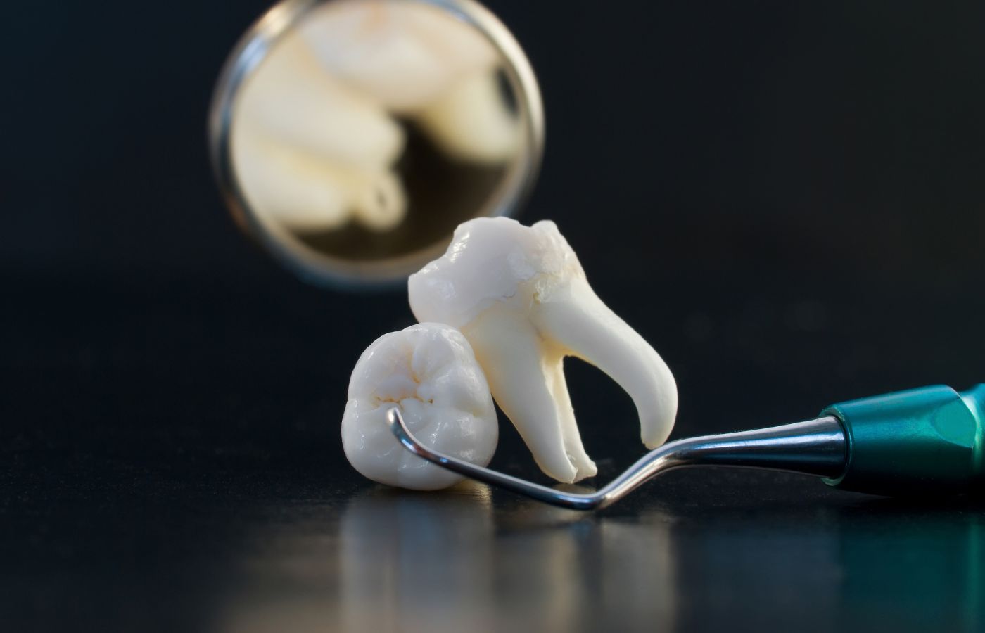 Impacted Wisdom Teeth: Causes, Symptoms & Treatments