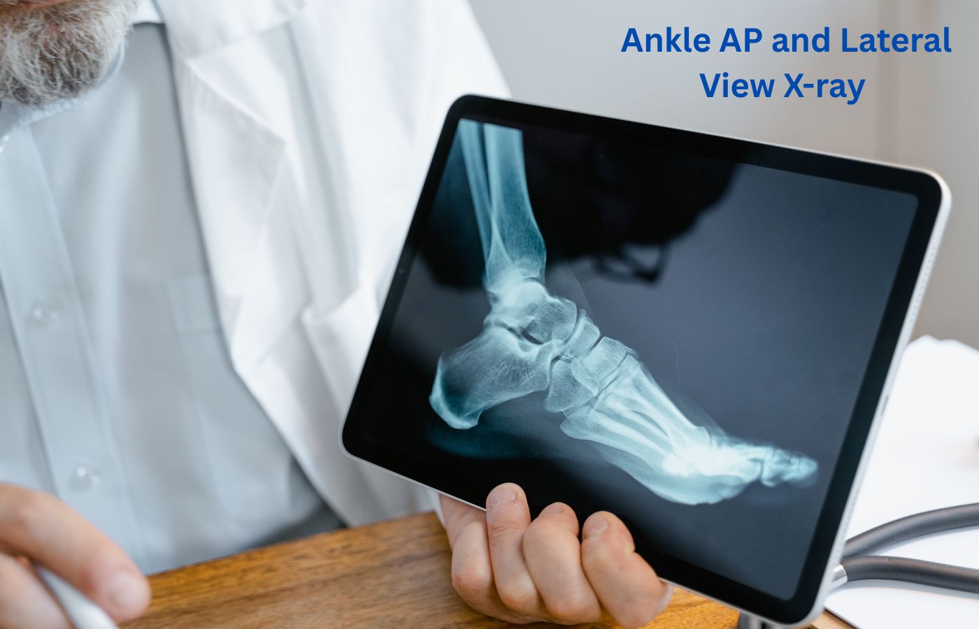 Ankle AP and Lateral View X-ray: Purpose and Diagnosis