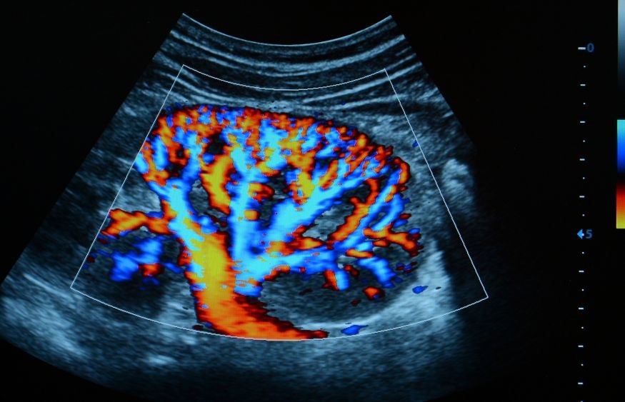 Prepare for an Artery Doppler Ultrasound | Diagnopein