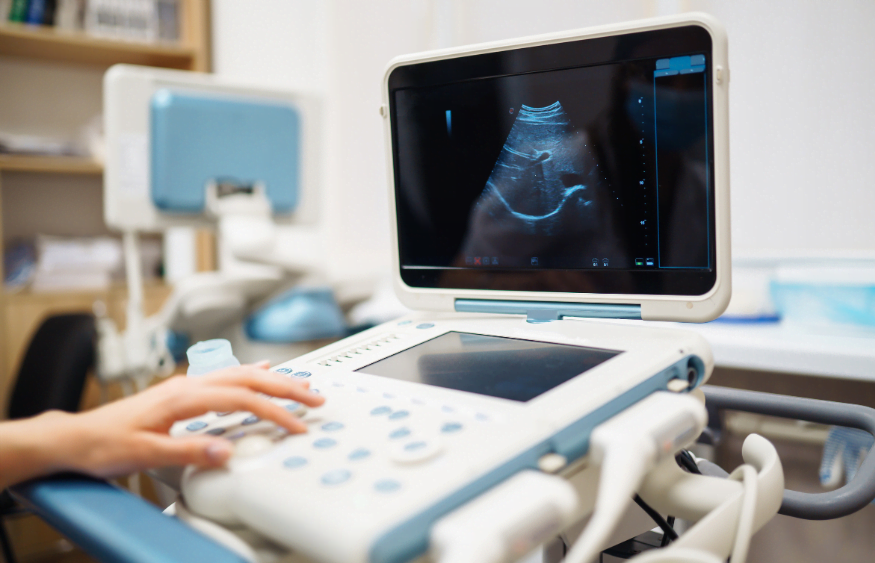 Ultrasound: Procedure, Purpose & Results Explained | Diagnopein Diagnostics