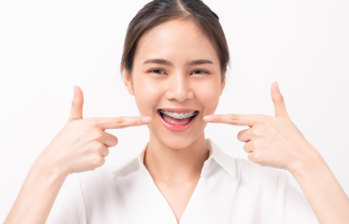 Find the Right Braces for Your Smile | Diagnopein
