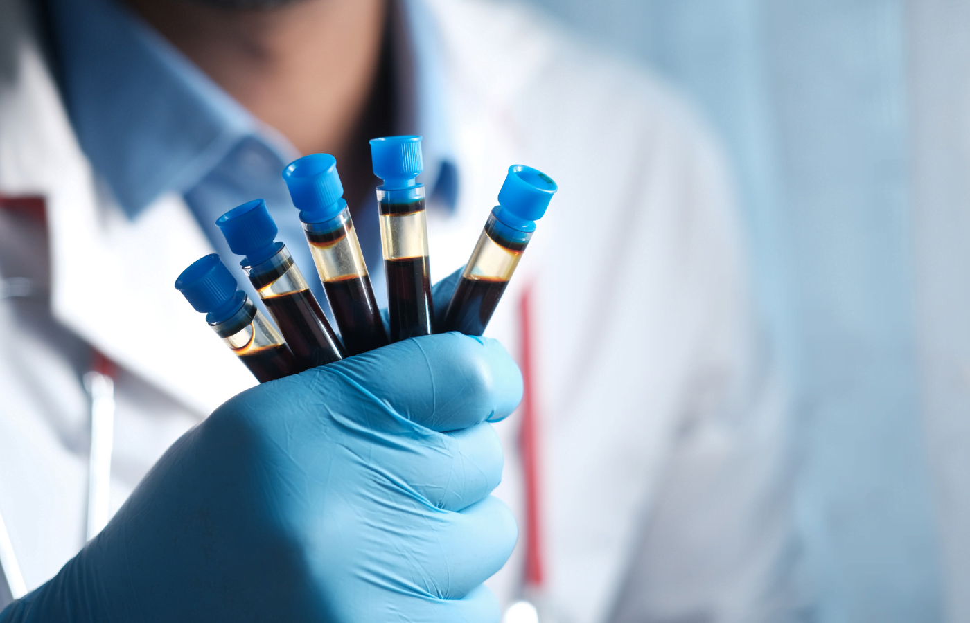 Blood Cancer & Leukemia: Symptoms & Treatment | Diagnopein