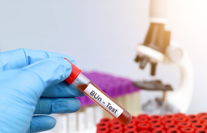 Blood Urea Nitrogen (BUN) Test | Diagnopein