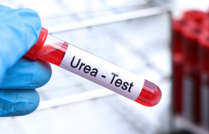 Blood Urea Nitrogen (BUN) Test | Diagnopein
