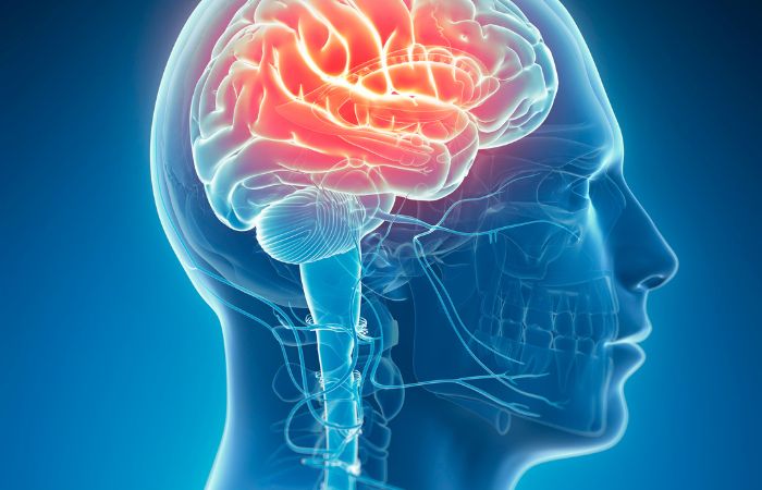 Brain Stroke: Causes, Types, and Risk Factors | Diagnopein