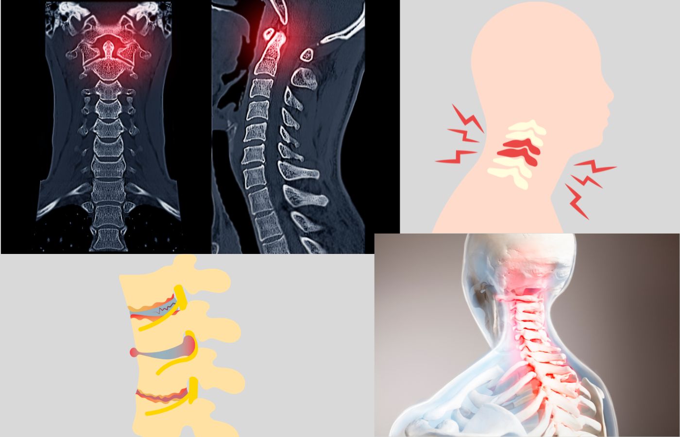 CT Cervical Spine Scan: Procedure, Uses & Importance