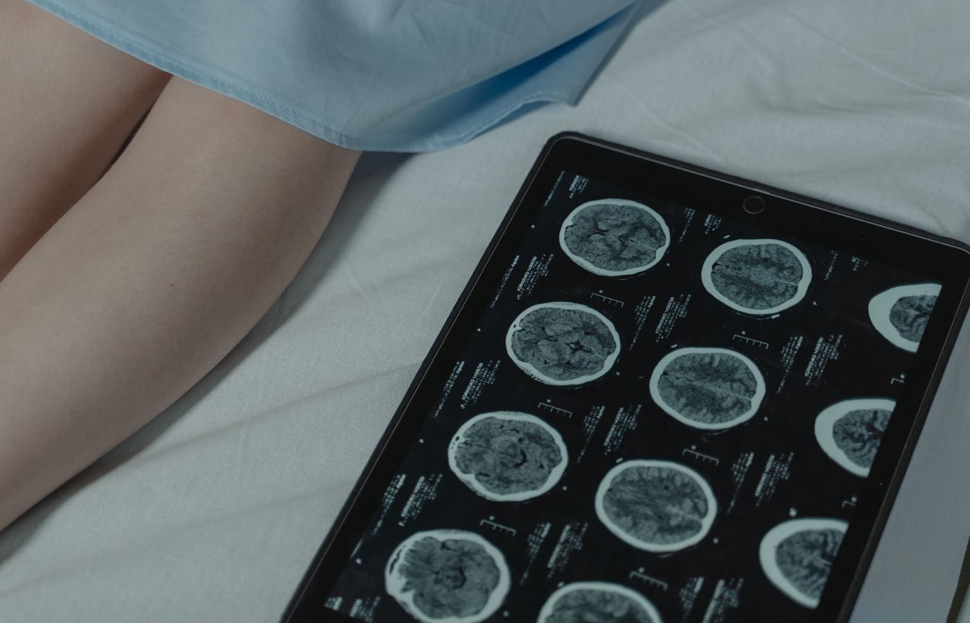 When Do You Need a CT PNS? Key Signs & Symptoms