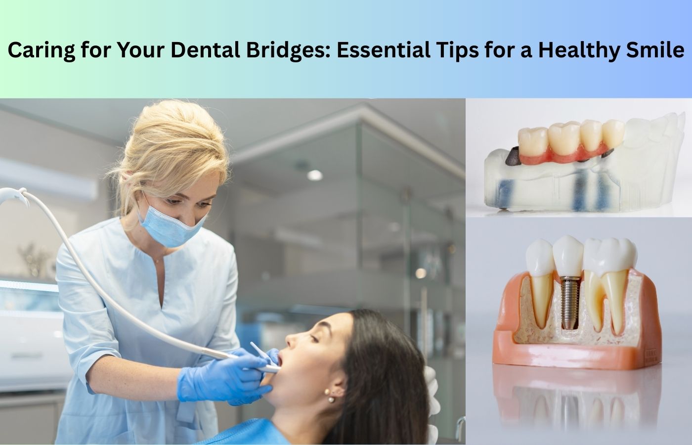 Caring for Dental Bridges: Tips for a Healthy, Lasting Smile