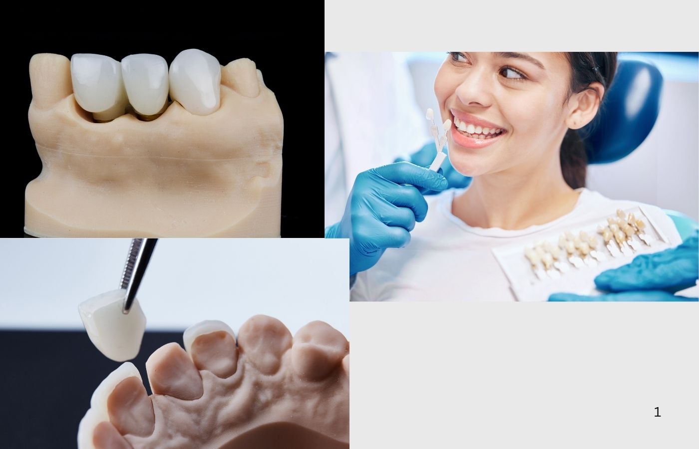 What is a Dental Crown? Why Do You Need One? | Dental Care