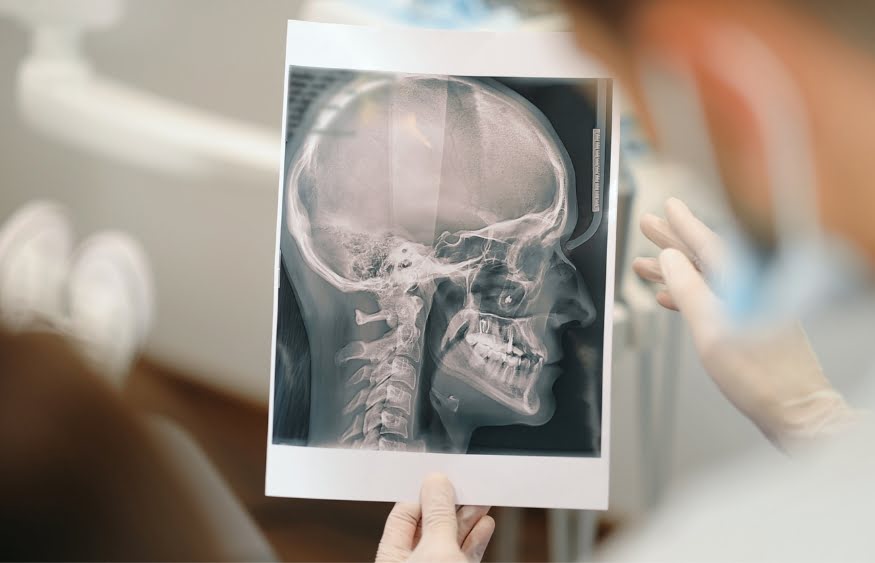 Digital Skull X-Rays Diagnose Head | Diagnopein