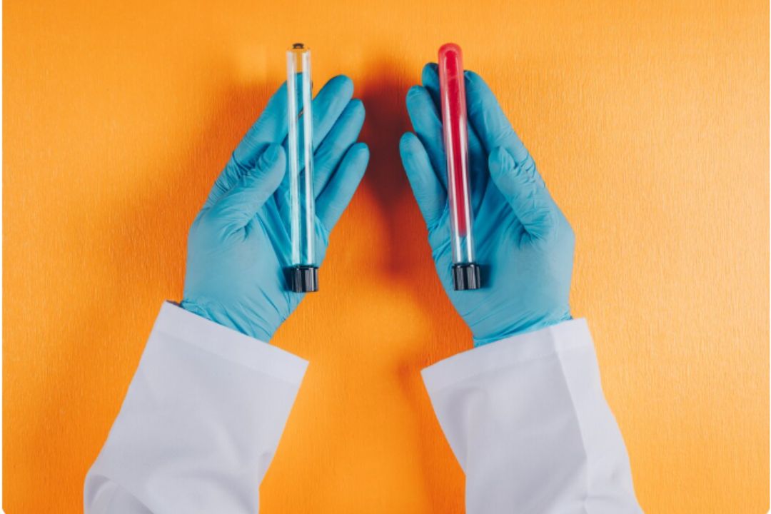 AMH Test vs FSH Test Which is More Accurate for Fertility | DiagnoPein