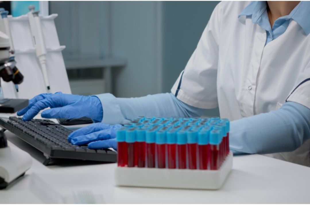 Spot Urine Sodium vs 24-Hour Test: Cost, Comfort & Accuracy | DiagnoPein