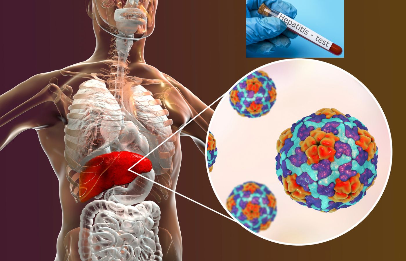 Hepatitis: Types, Symptoms & Diagnosis Explained