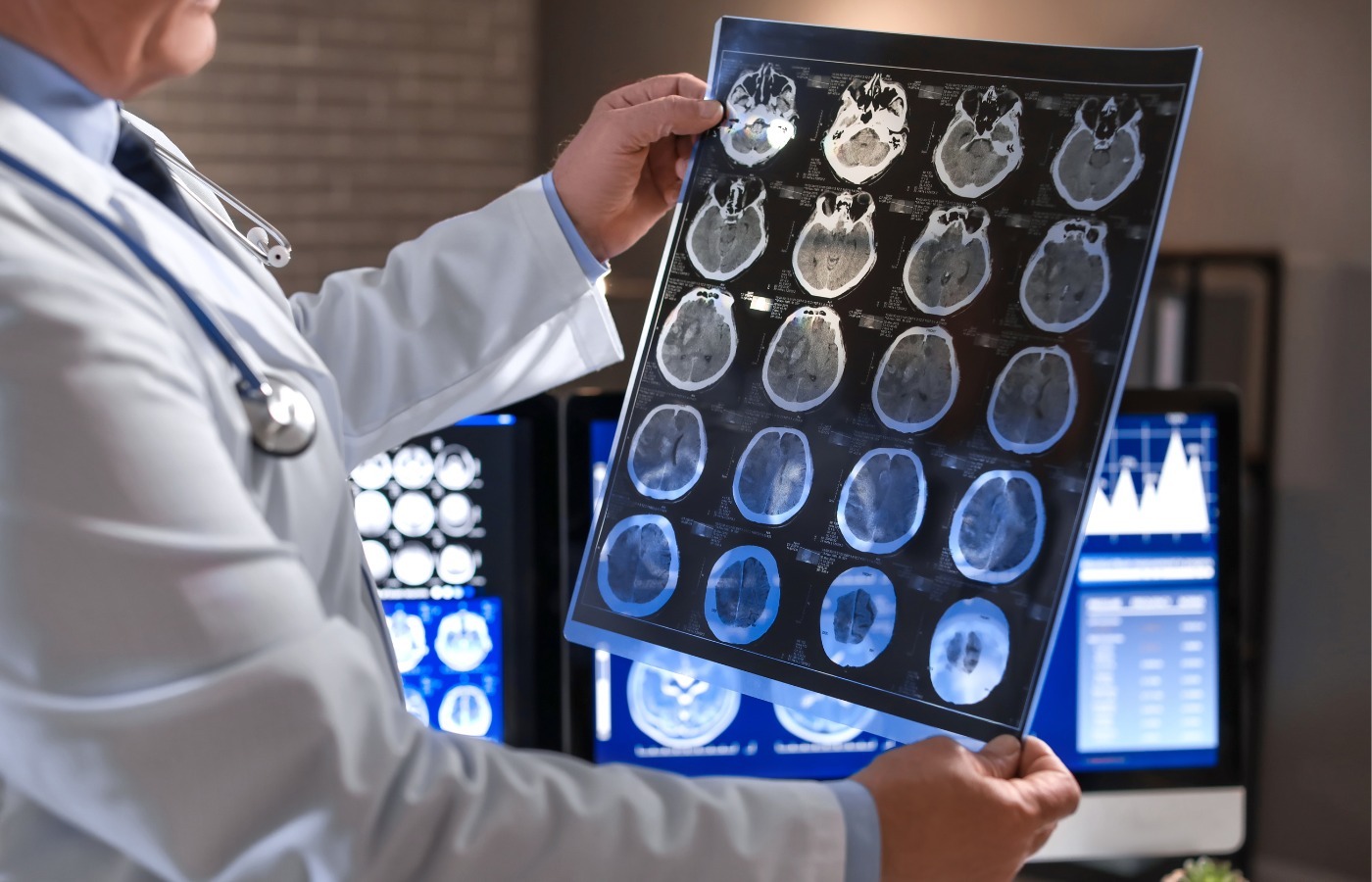 Understanding Risks and Benefits Of MRI Head Scan | Diagnopein