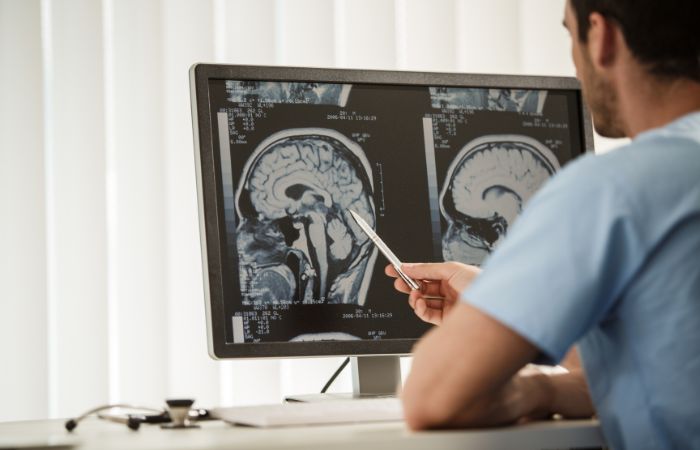 MRI for Headaches and Migraines | Diagnopein