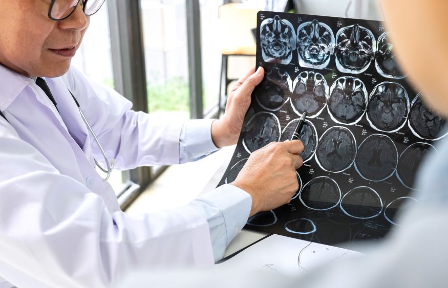 What Is an MRI Scan? A Complete Guide to MRI Technology |Diagnopein