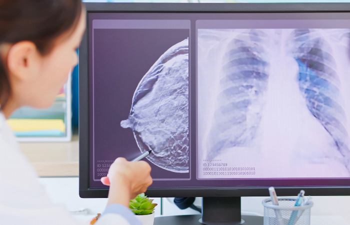 MRI Scan for Hip Pain | Book MRI Scan Near You | Diagnopein