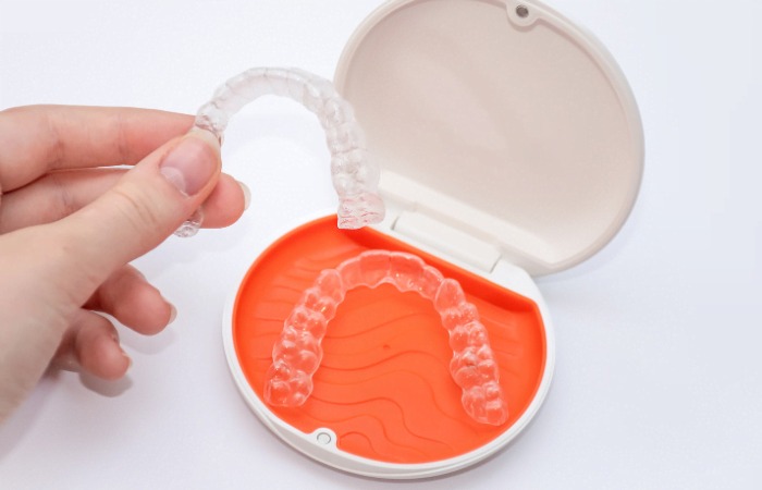 The Magic of Clear Aligners: Modern Teeth Straightening at Diagnopein