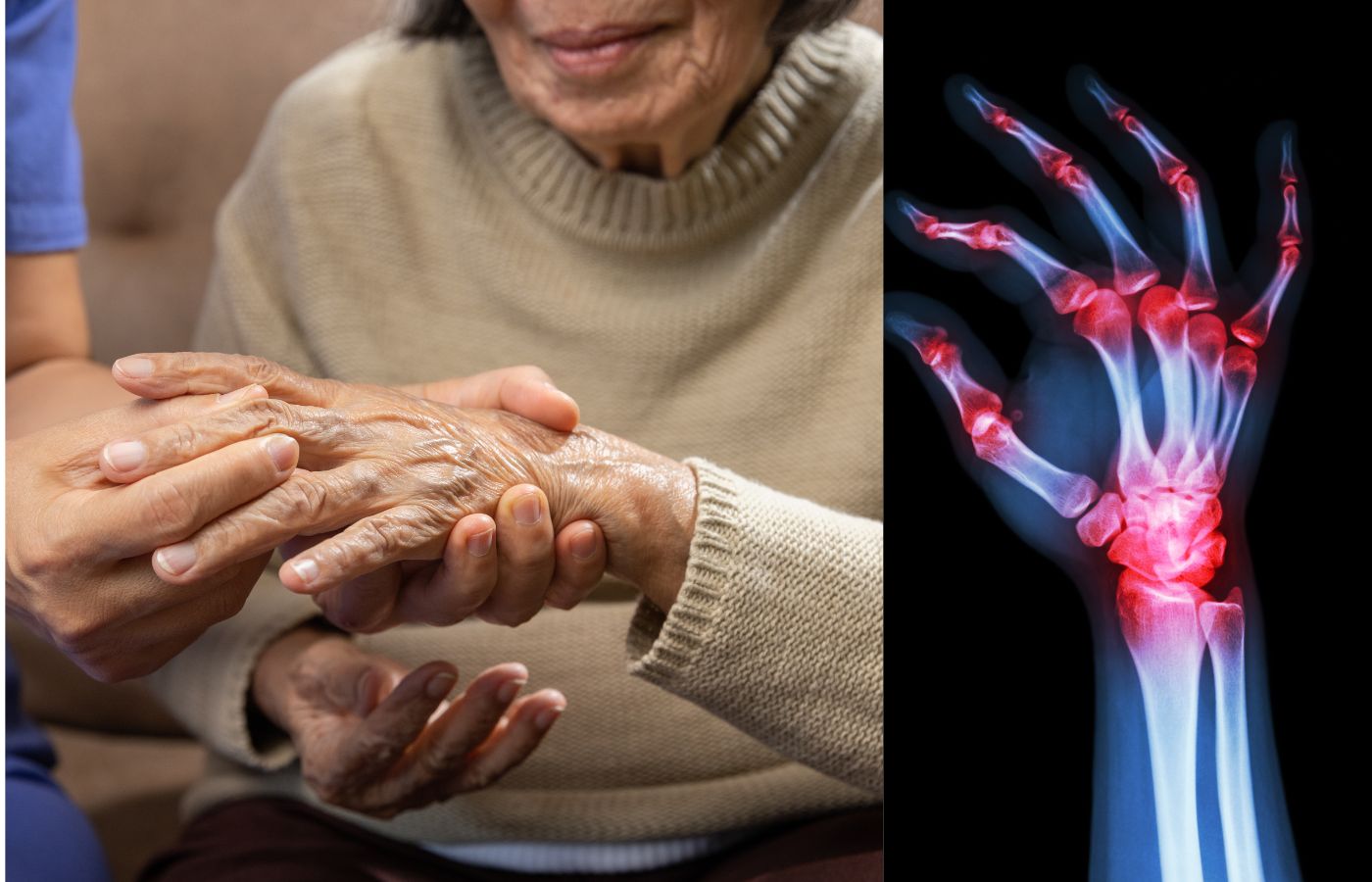 What is Rheumatoid Arthritis? Diagnosis & Tests Explained