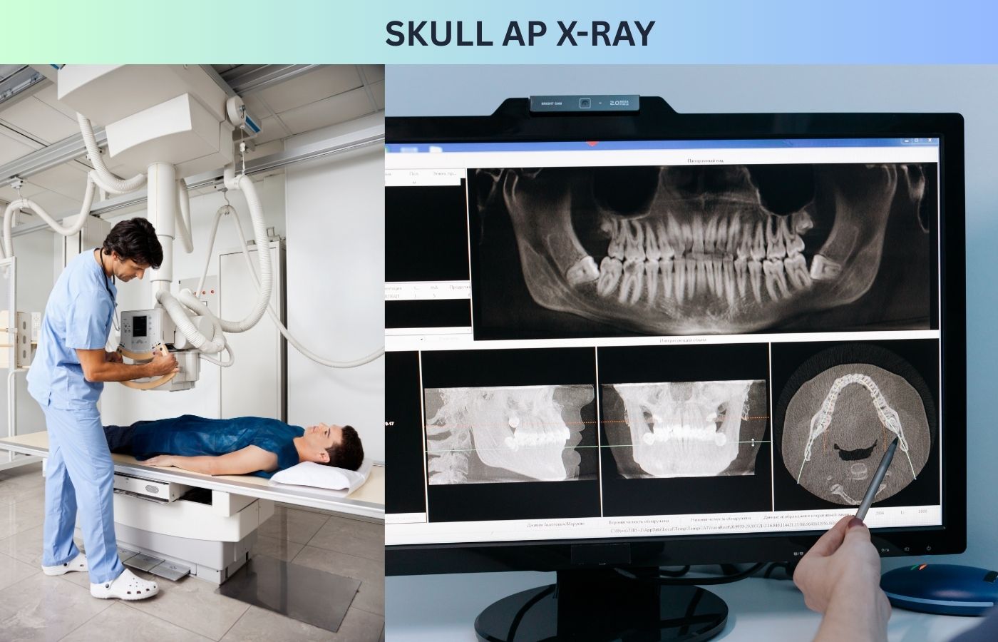 Ankle AP and Lateral View X-ray: Purpose and Diagnosis