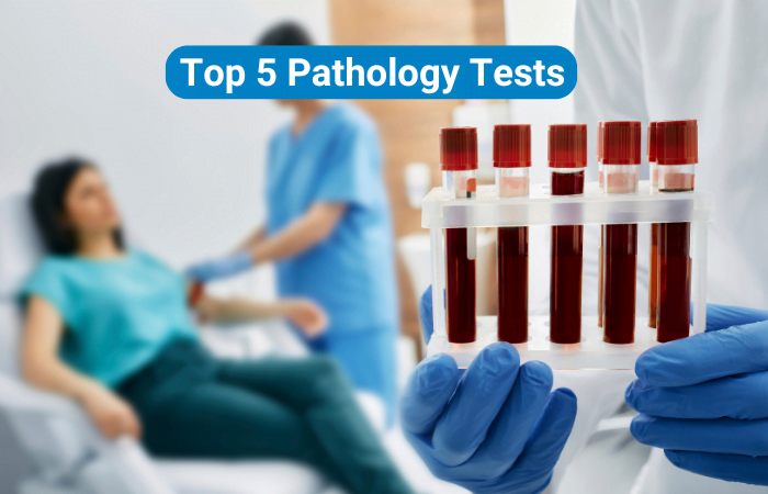 Top 5 Pathology Tests Essential for Your Health Checkup | Diagnopein