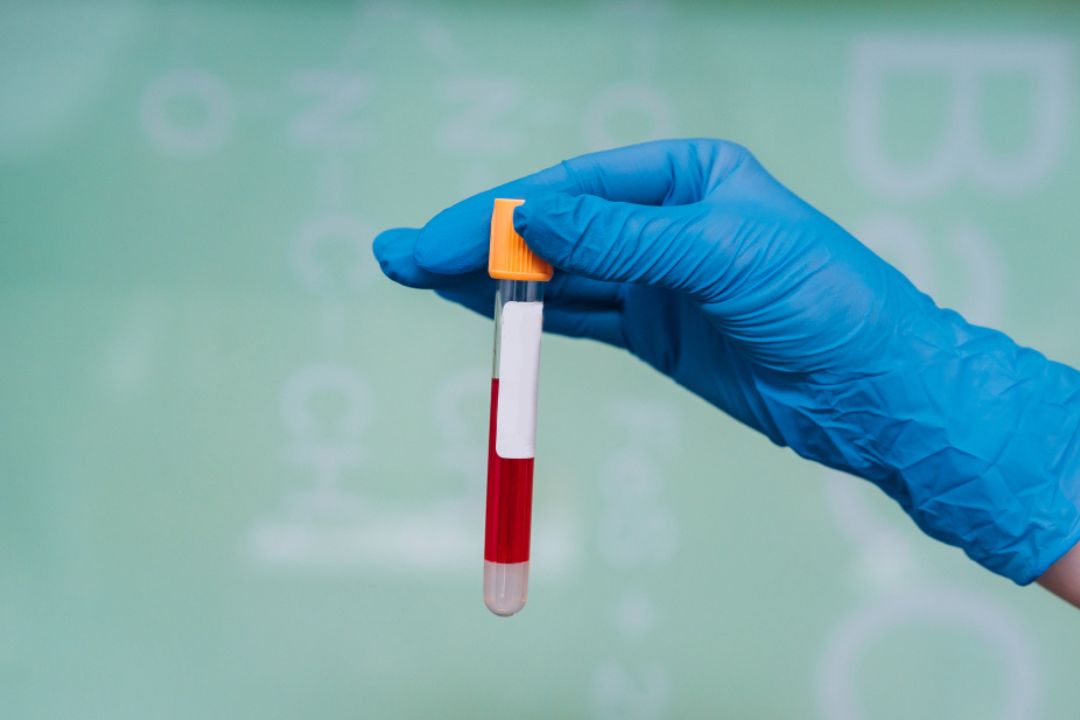 Triple Marker Test vs Double Marker Test in Pregnancy | Which Is Better