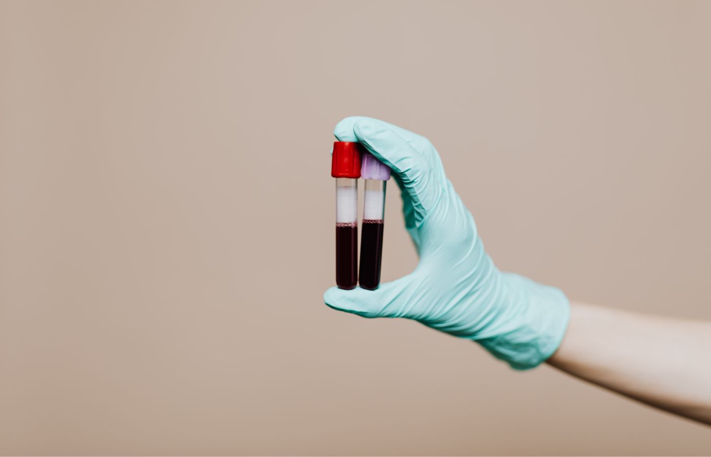 What Is a Blood Infection? Symptoms & Tests | Diagnopein