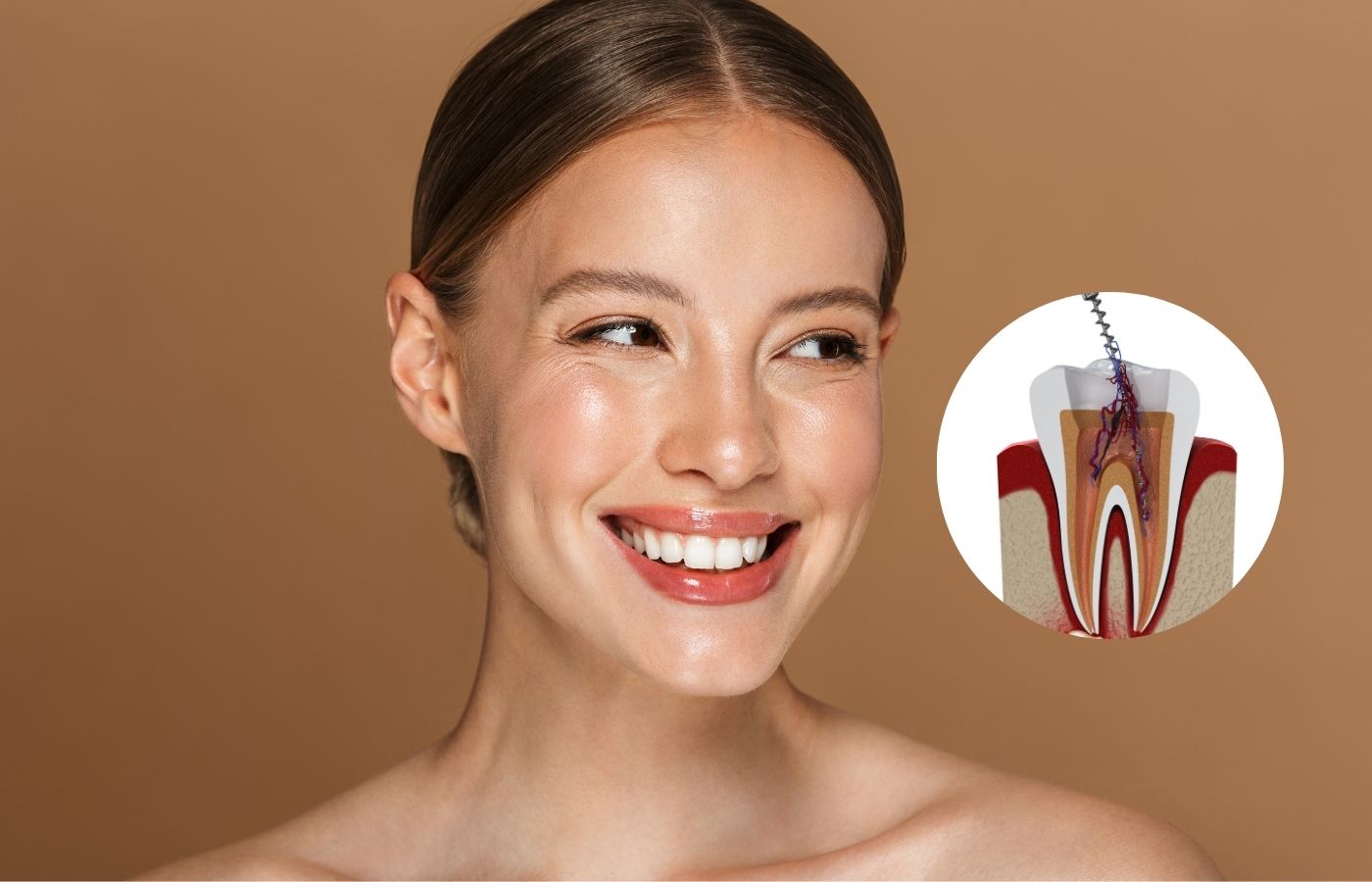 Root Canal & Capping Cost in India 2024 | Procedure, Benefits & Why You ...
