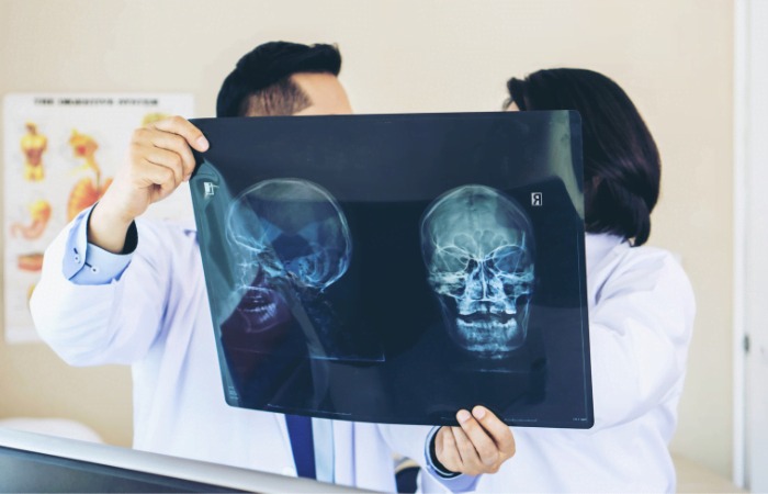 Affordable X-ray Skull AP Scan | Diagnopein