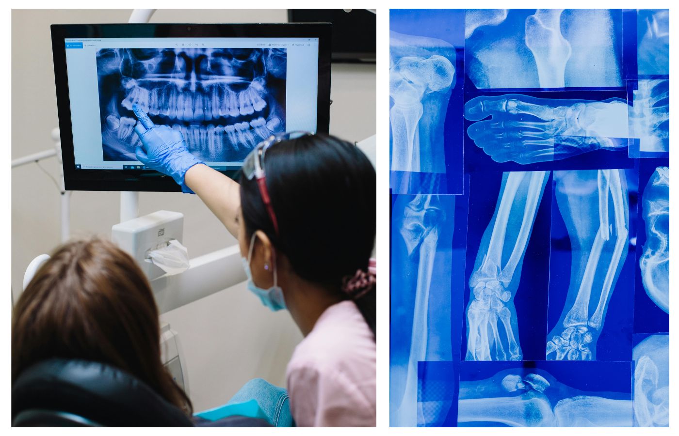 How X-rays Help Detect Spine Injuries & Deformities