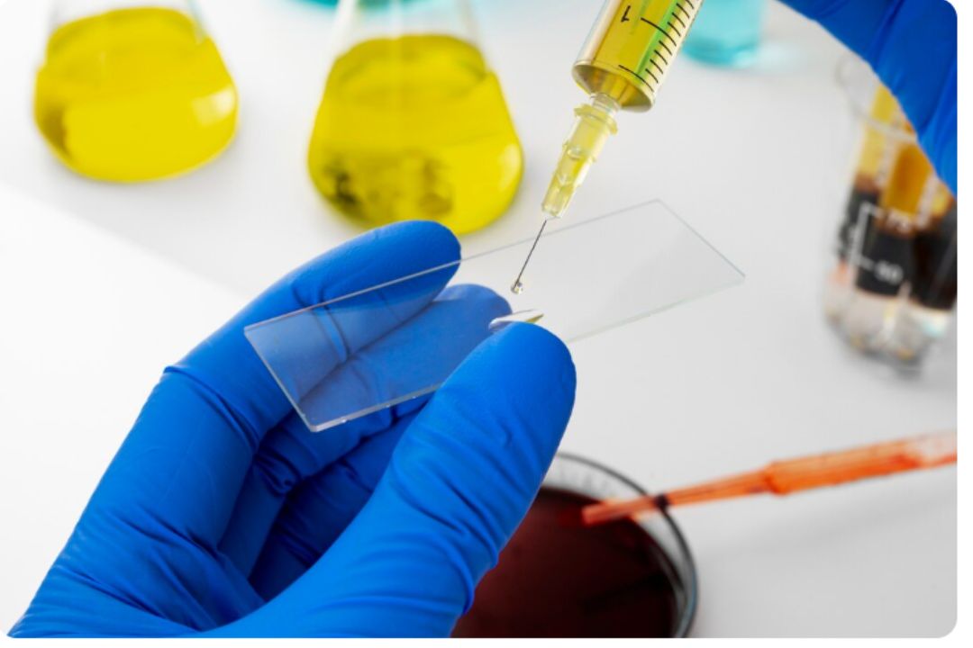 Urine Potassium Test The Diagnosing Hypokalemia | Diagnopein