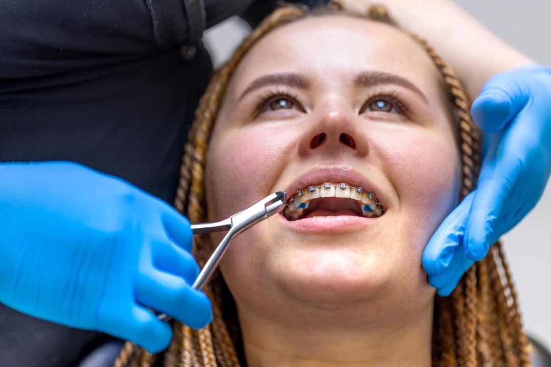 Can Braces Fix Jaw Problems & Bite Issues? | Diagnopein Guide