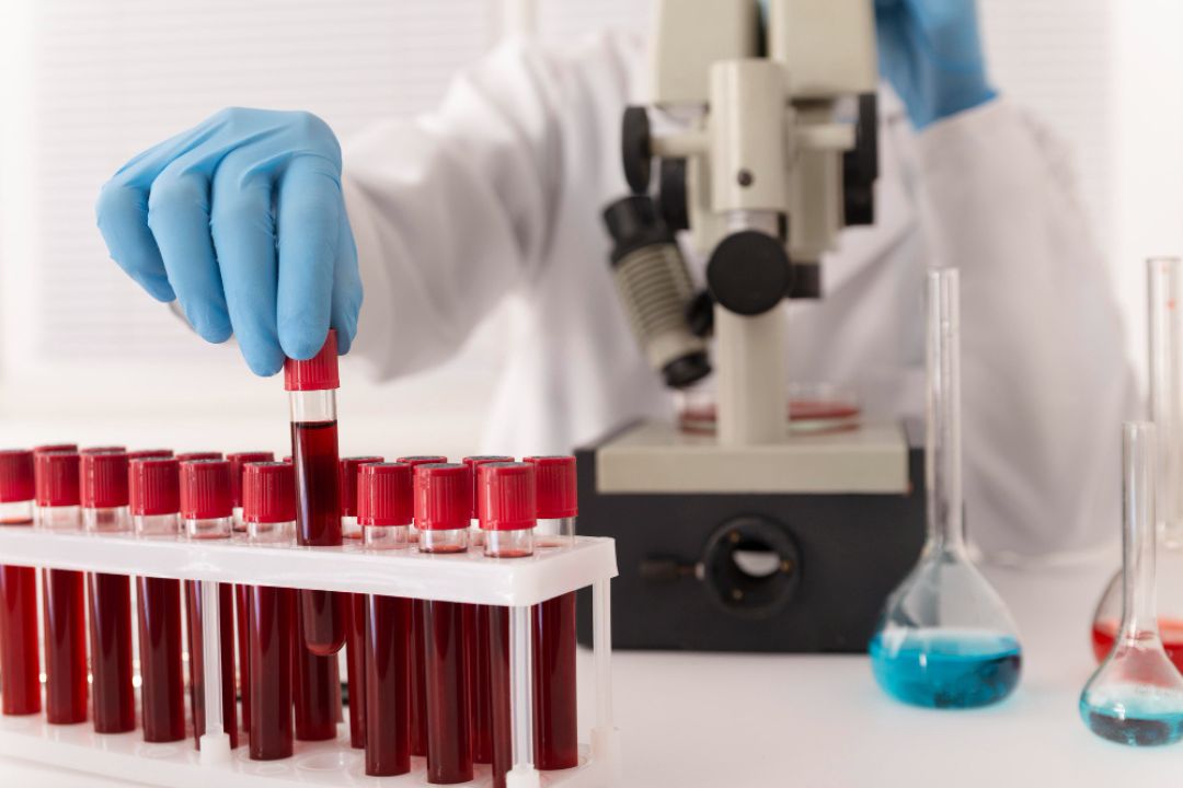 How Blood Infections Spread: Causes & Prevention | Diagnopein