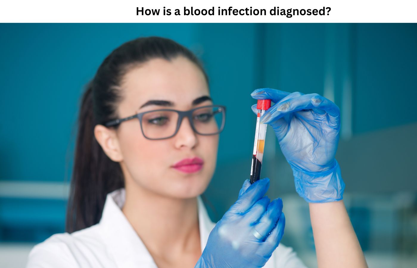 What Is a Blood Infection? Symptoms & Tests | Diagnopein