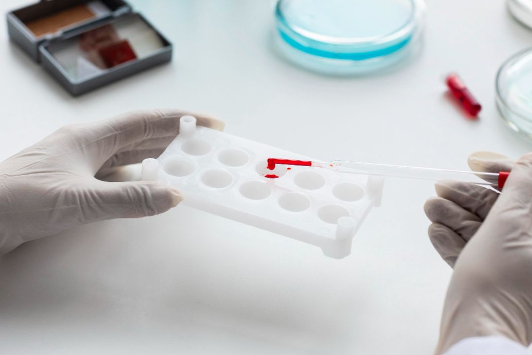 BUN Blood Test Explained: High, Low, & Normal Levels | Diagnopein