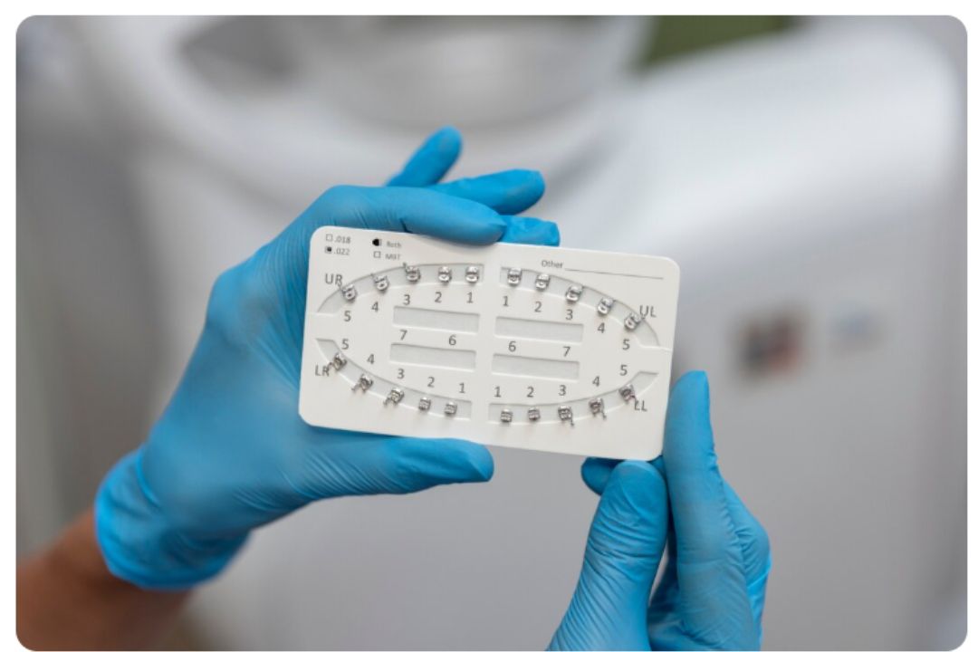 Dental Braces Cost in India: Complete Price Guide and Why Choose Diagnopein