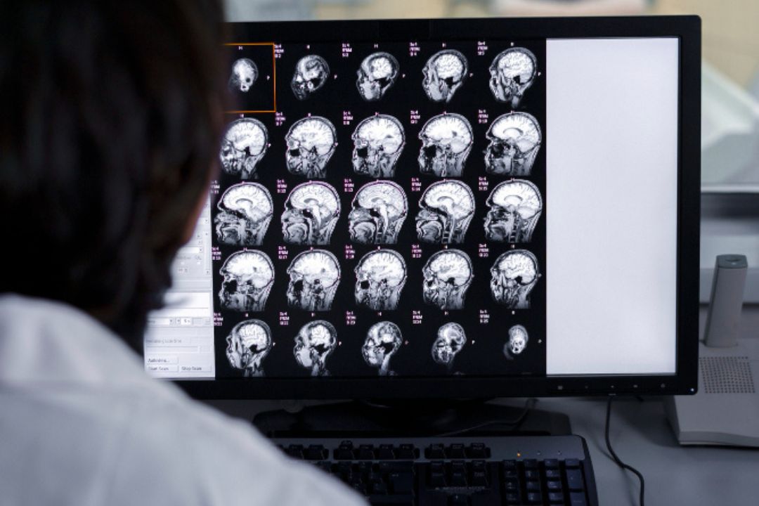 CT Brain Scan: Your Guide to Diagnosing Headaches, Strokes & Tumors ...