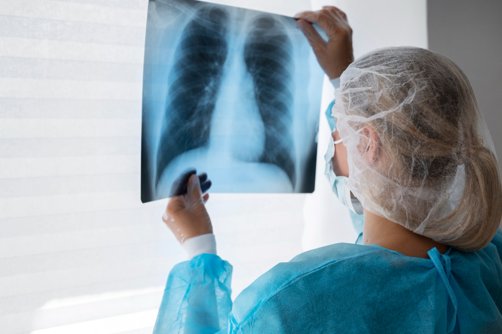 HRCT Chest: Key Tool in Diagnosing Lung Diseases