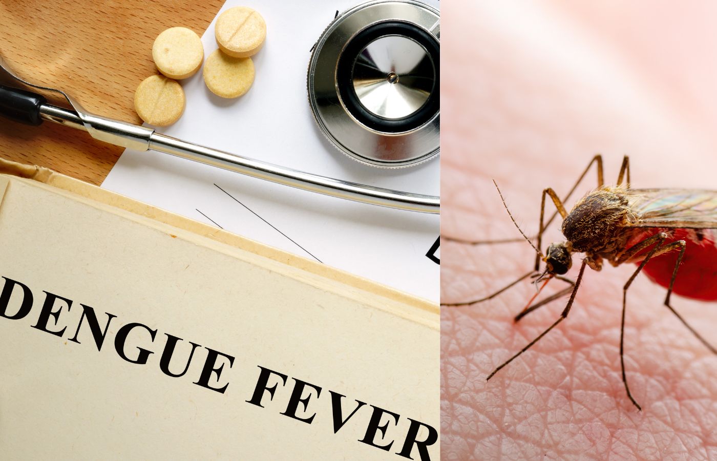 How is Dengue Diagnosed and Treated? Can Dengue Be Prevented?