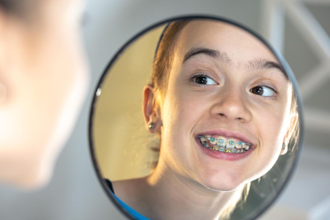 Do Braces Change Your Face Shape? Myths vs. Facts | Diagnopein
