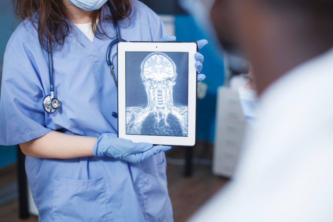 Digital Skull X-Rays in Neurology: Benefits, Cost & Diagnostic Power
