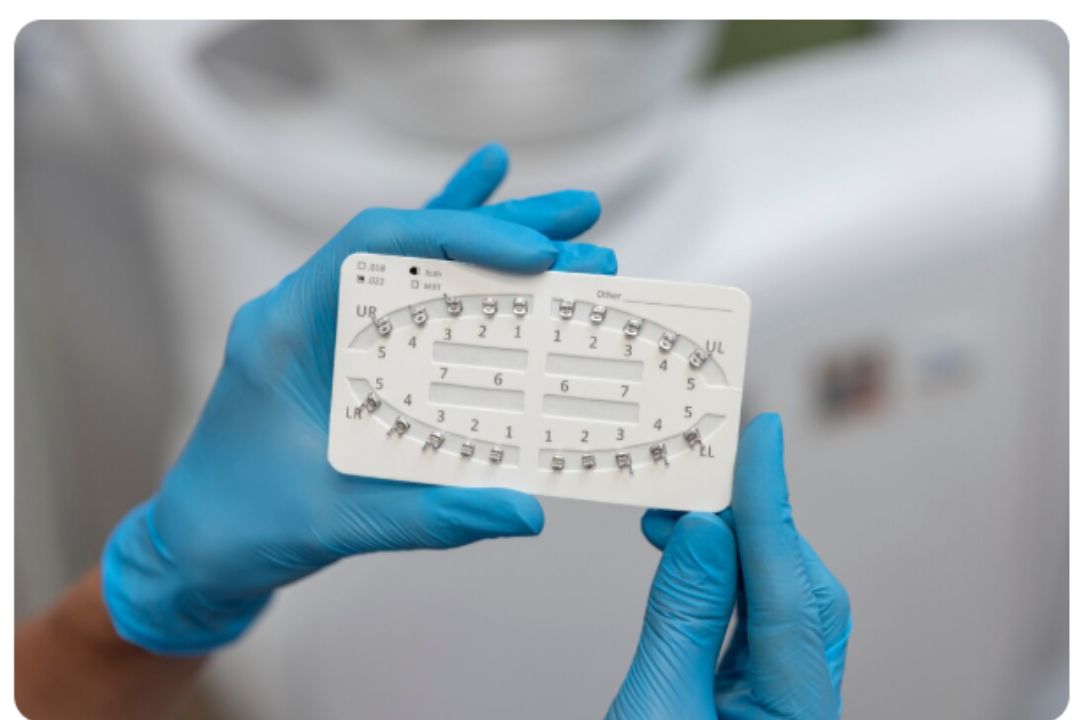 Fixed and Removable Braces Cost and Guide | Diagnopein