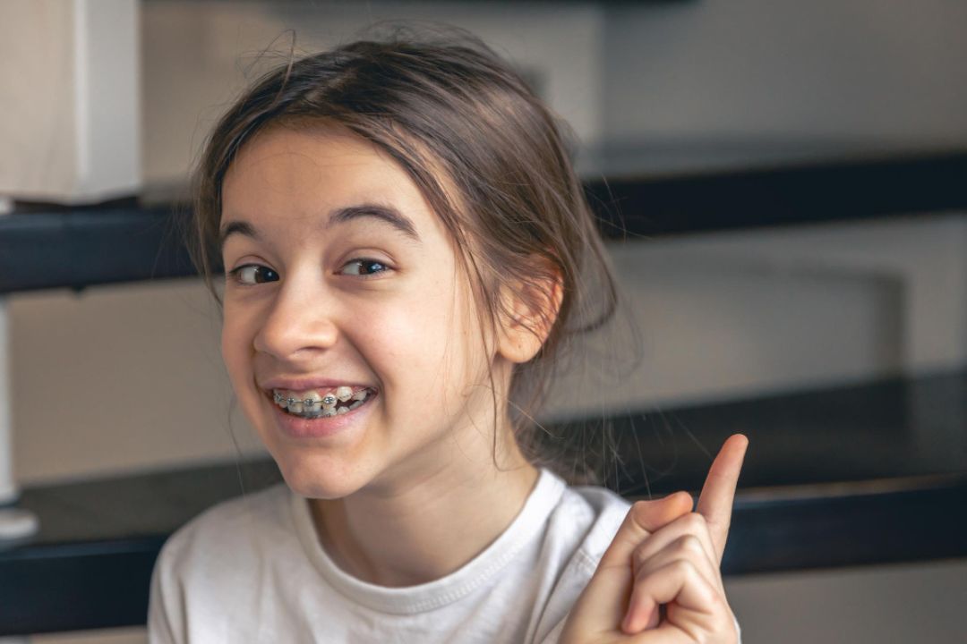 Life with Braces First 30 Days What to Expect | Diagnopein