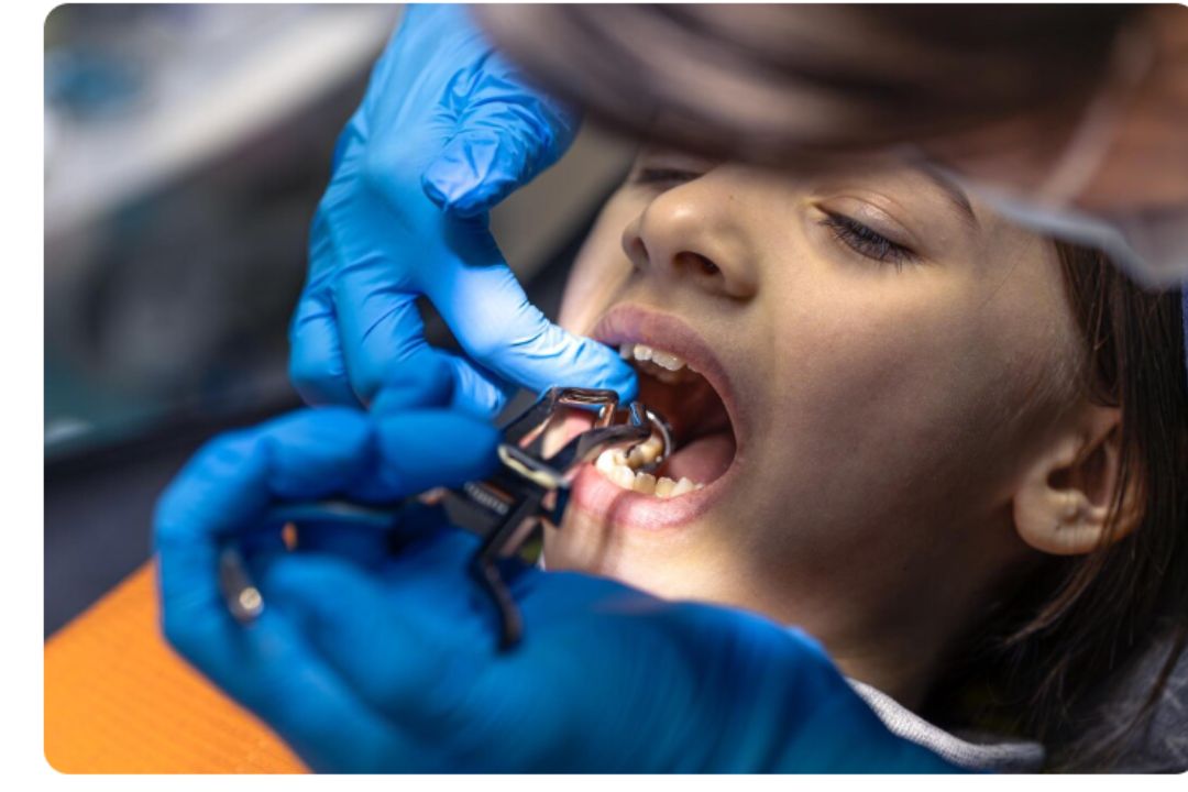 Toothsi Clear Braces Pricing in India Cost Benefits and Comparison with ...