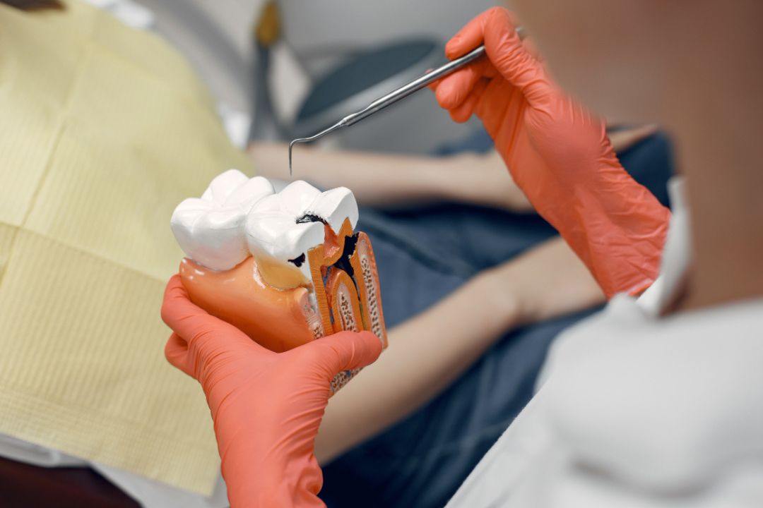 Root Canal and Capping Cost in India 2024 | Procedure, Benefits