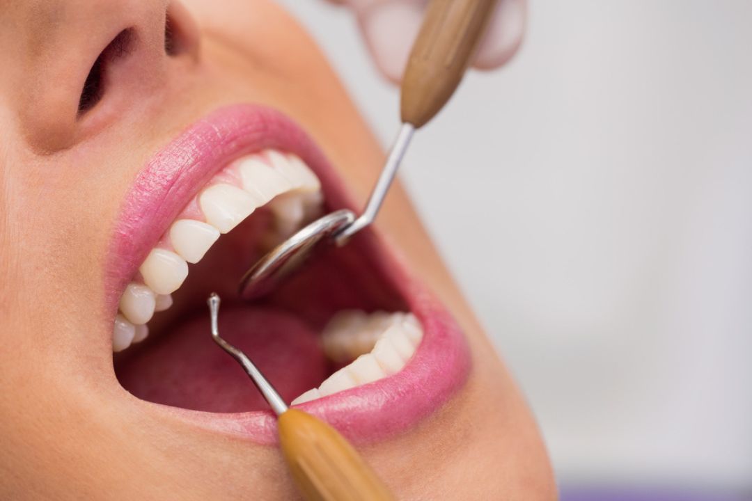 Can Cleaning Damage My Teeth? Myths & Facts Explained.