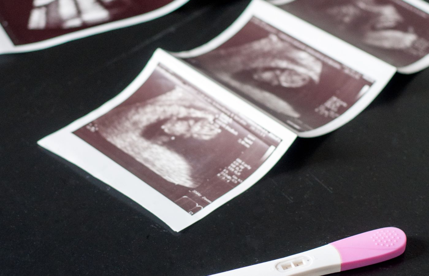 Complete Guide for USG Anomaly Scan | Diagnopein