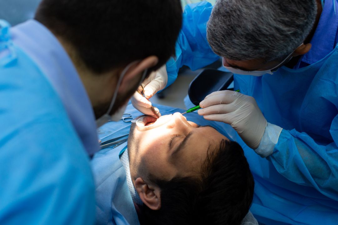 Impacted Wisdom Teeth: Causes, Symptoms & Treatments