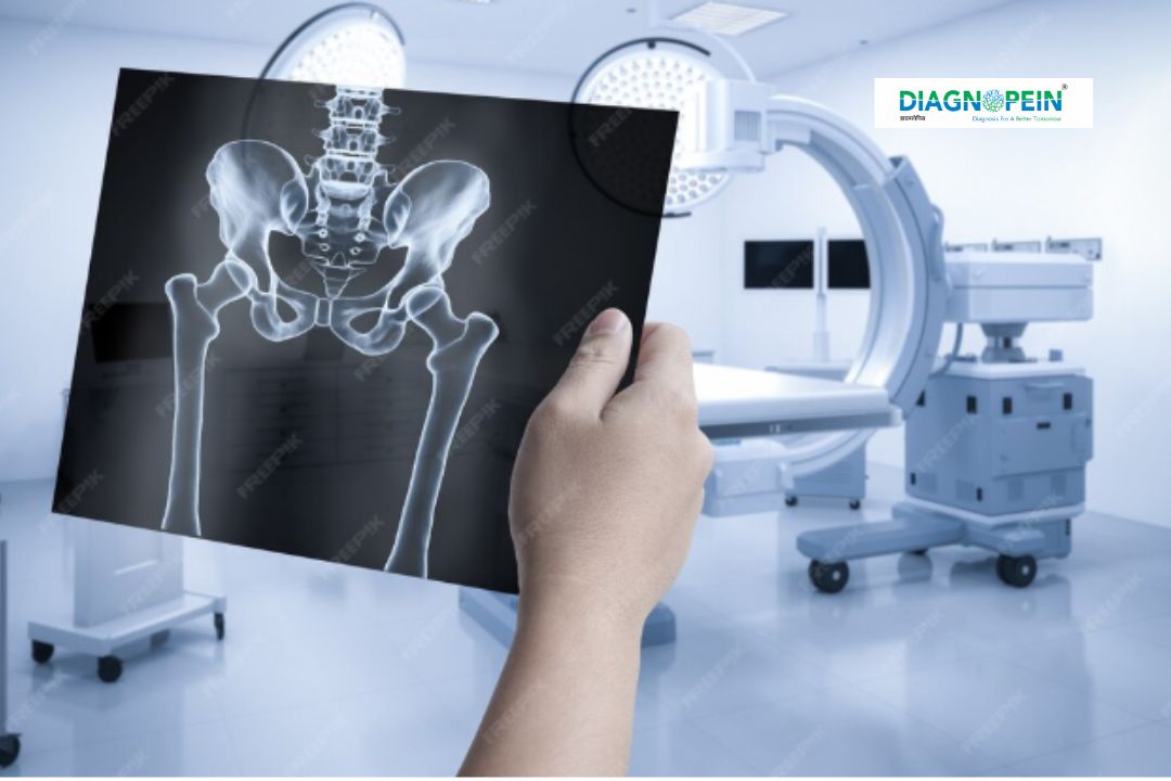 CT Abdomen & Pelvis Scan – Accurate Diagnostic Imaging