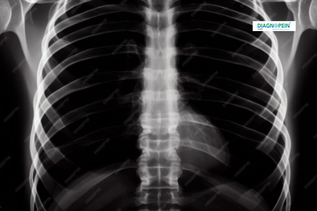 CT Chest Abdomen Plain Scan – Purpose, Procedure & Benefits